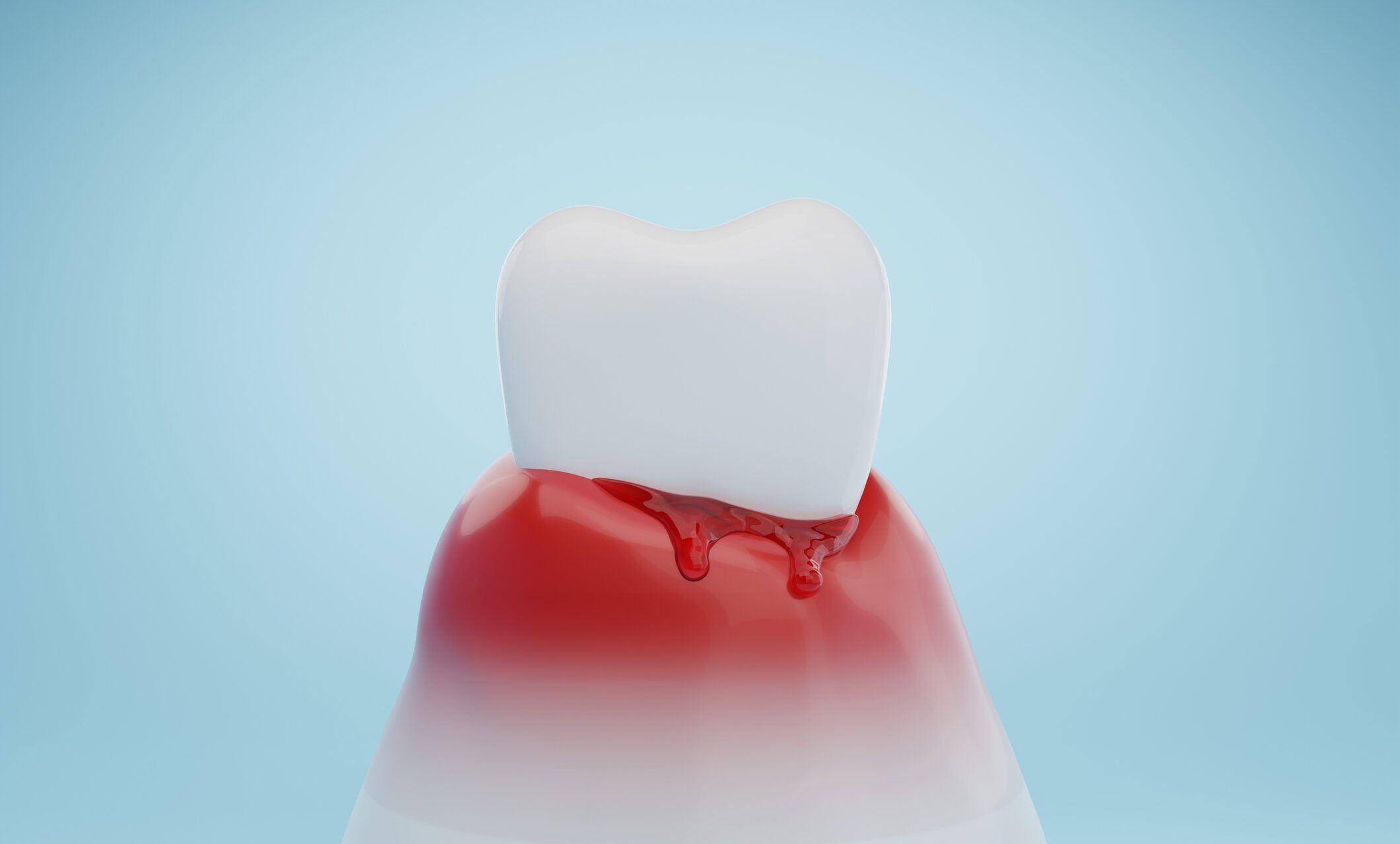 Swollen Gums: Causes, Symptoms, Treatment, and Prevention