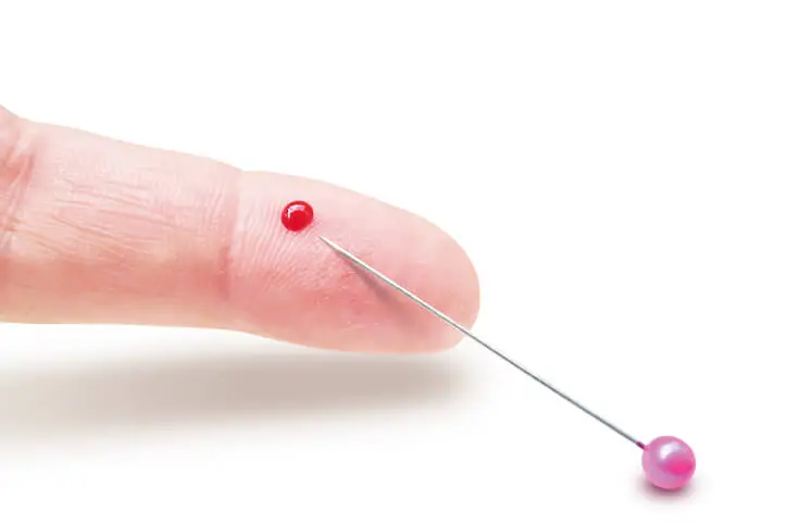 Needle Stick Injuries in Dentistry: Risks, Prevention, Management