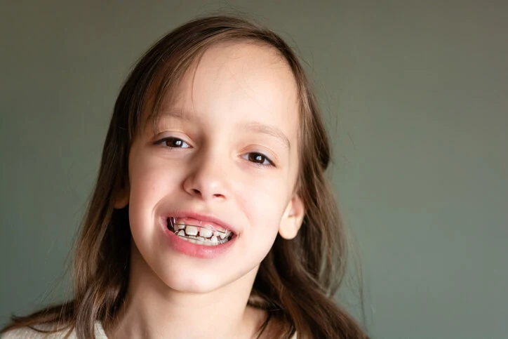 The effects of Twin block treatment on skeletal and dental changes in ...